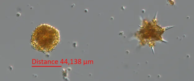 Xanthidium Cristatum Brb Ex Ralfs Nordic Microalgae Full Article: