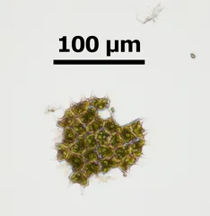 Nordic Microalgae